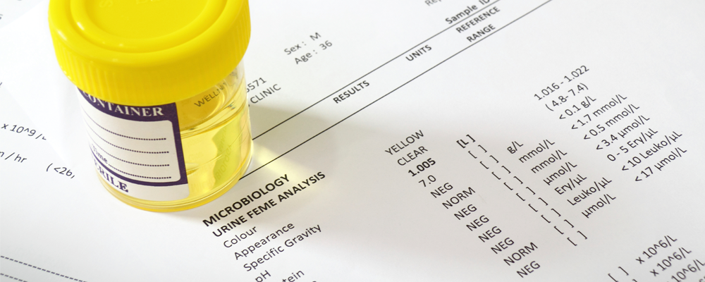 Drug Tests in Gretna, LA | The Drug Testing Place